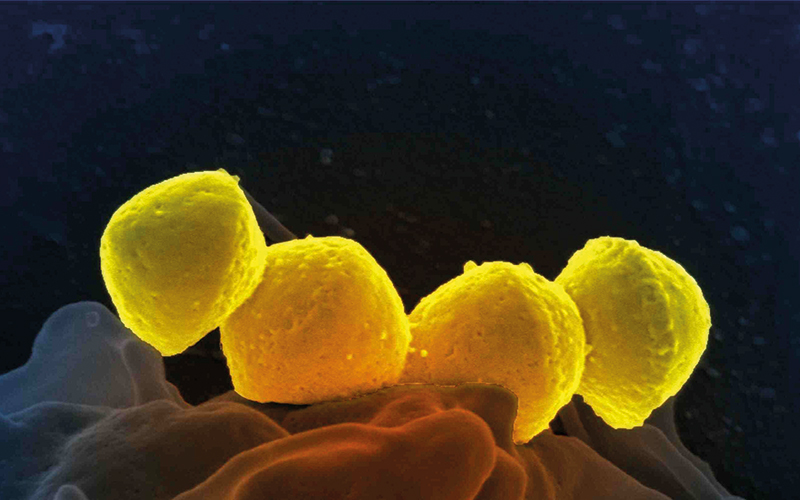 Strep A in the spotlight - Community Practitioner