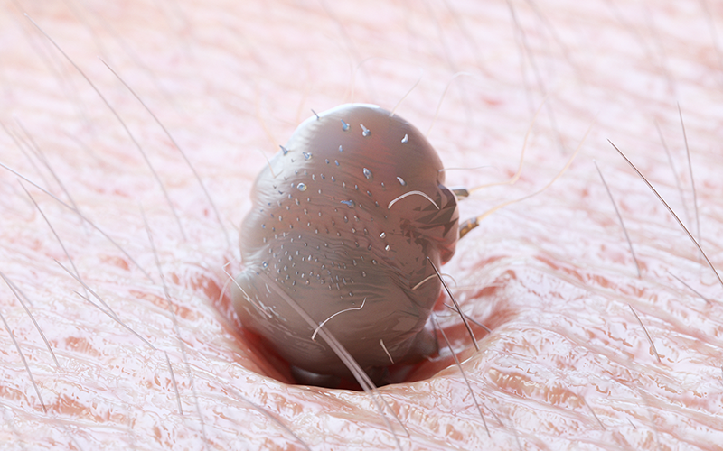 Back to basics: scabies - Community Practitioner